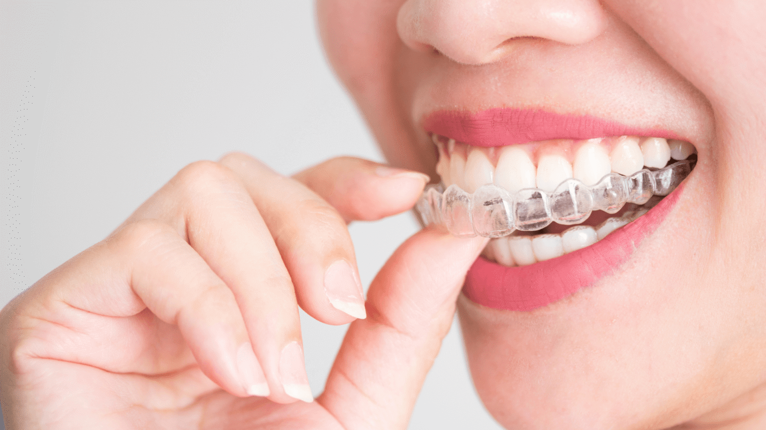 3 Best Invisalign Patient Appointment Software for a Dental Office ...